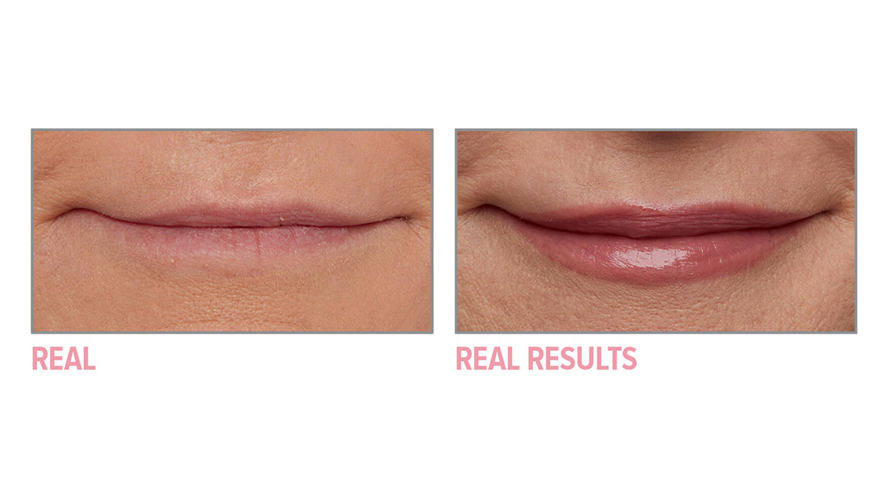 Pillow Lips Solid Serum Lip Gloss - IT Cosmetics