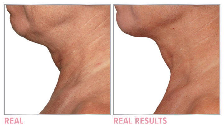 Confidence in a Neck Cream Moisturizer | IT Cosmetics