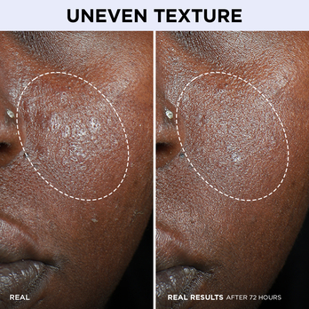 Confidence in a Cream Barrier Boost Skin Barrier Repair Moisturizer